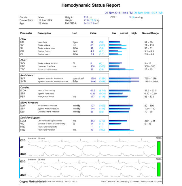 Key Features - Electrical Cardiometry™ Portfolio │ OSYPKA MEDICAL